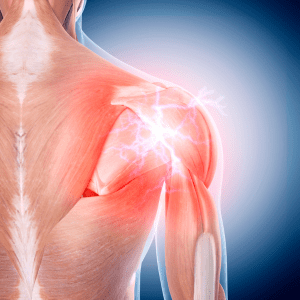 Shoulder Pain In Jackson | Jackson MS Chiropractor | 39213 | Armstrong ...